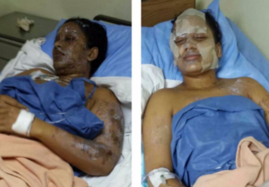 Desconocidos rocían ácido del diablo a joven en SFM